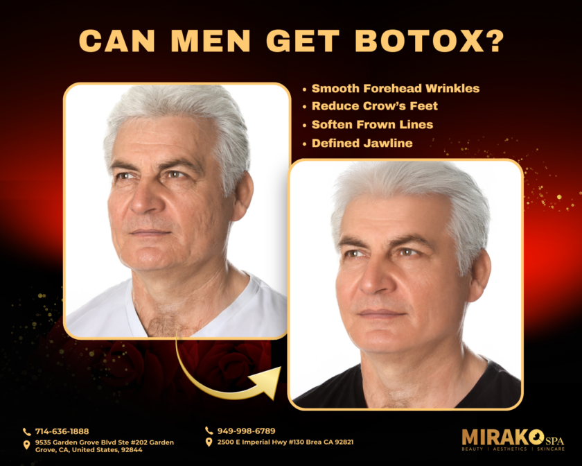 Can Men Get Botox? Breaking the Stigma and Reaping